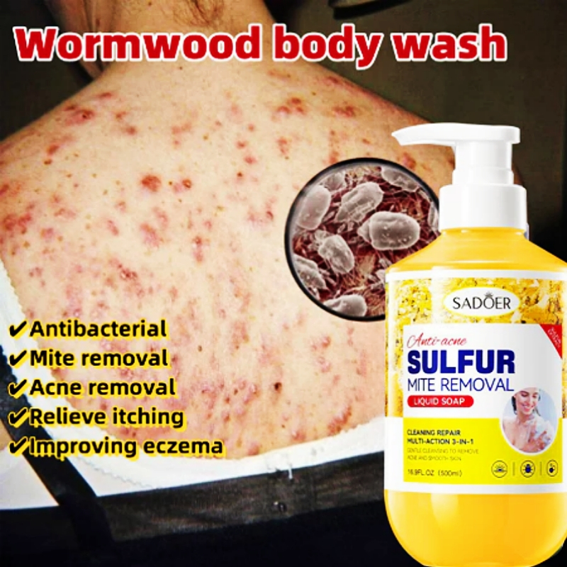 acne body wash anti mite shower gel sulfur body wash sabun badan jerawat antibacterial body wash ...