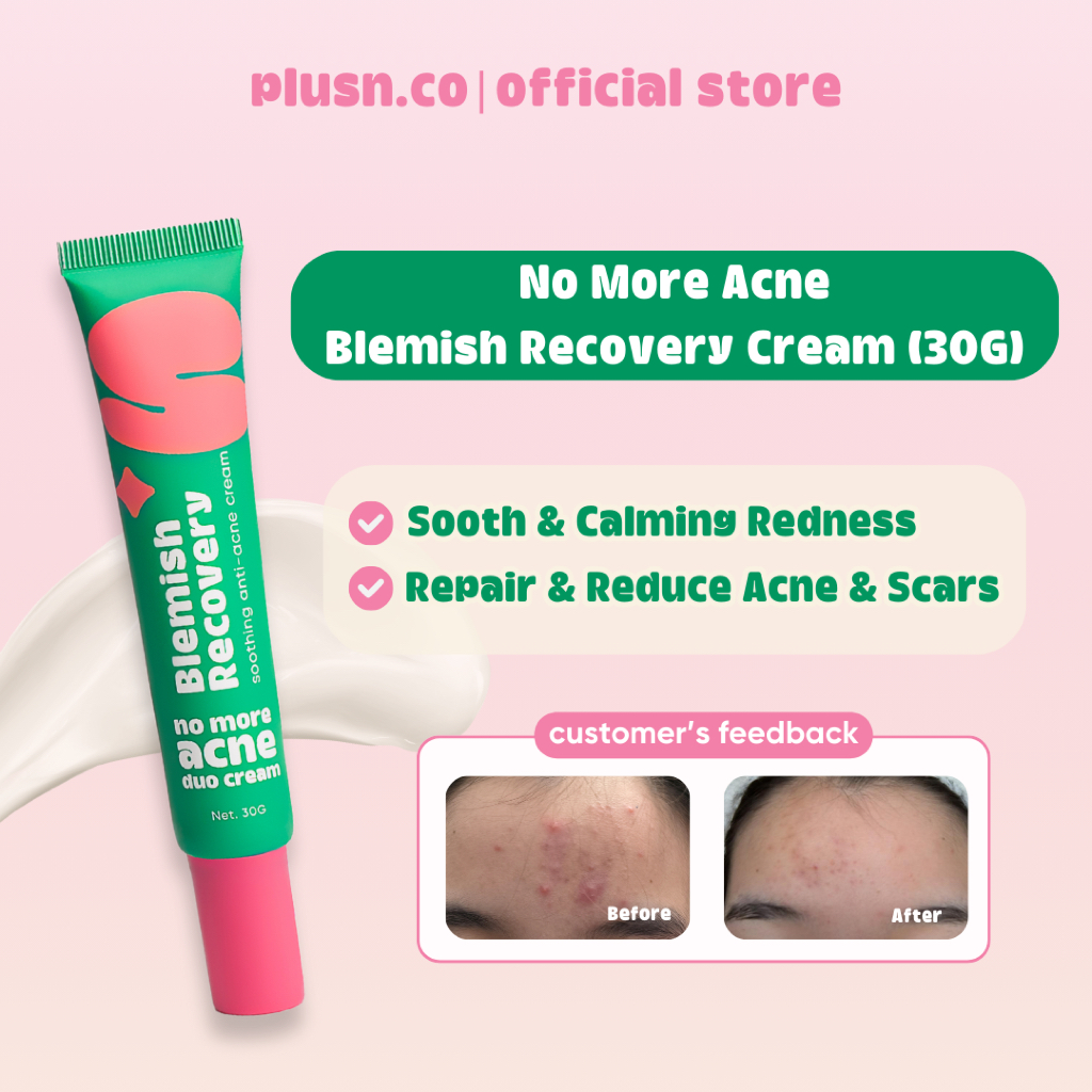 No More Acne Blemish Recovery Cream (30g) Reduce Acne & Scars Repair ...