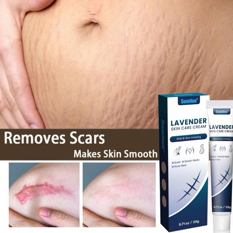 LAVENDER SKIN SCAR CREAM krim penghilang parut lama dan parut baru ...