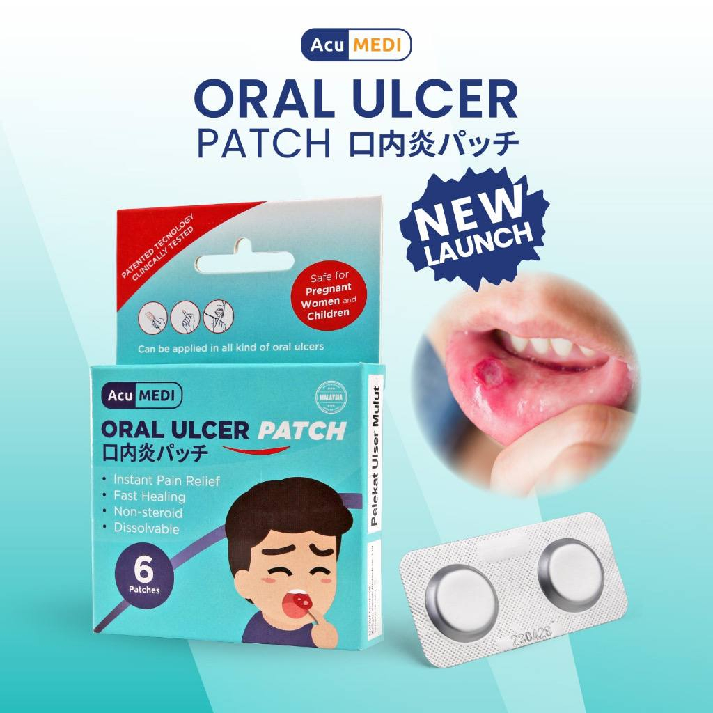 Mouth Ulcer Patch Pelekat Ulcer Mulut AcuMEDI Oral Ulcer Patch for Ulcer Treatment - 6 patches ...