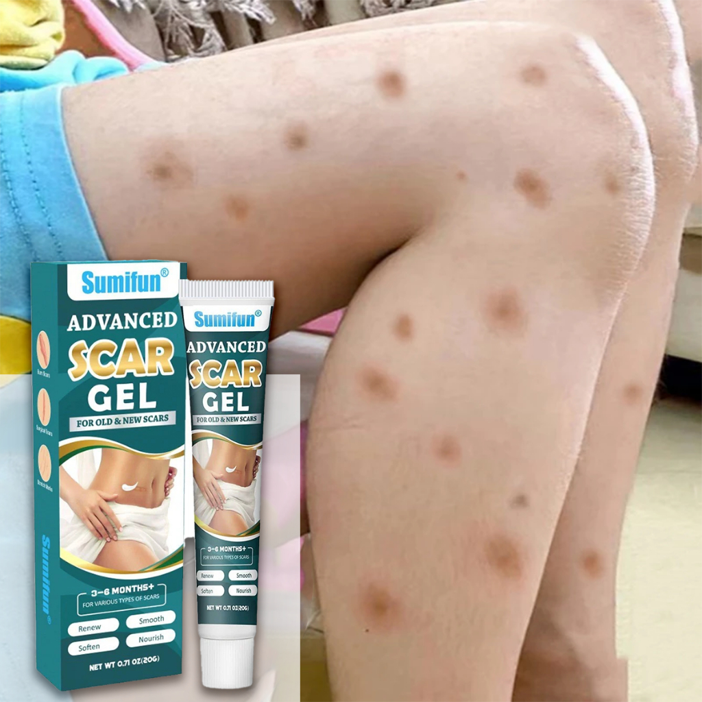 Hilangkan Parut Hitam Scar Removal Cream Remove Stretch Marks Burns ...