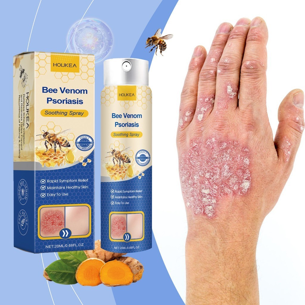 Bee-Venom Psoriasis Health Care Cream Treatment Soothing and ...