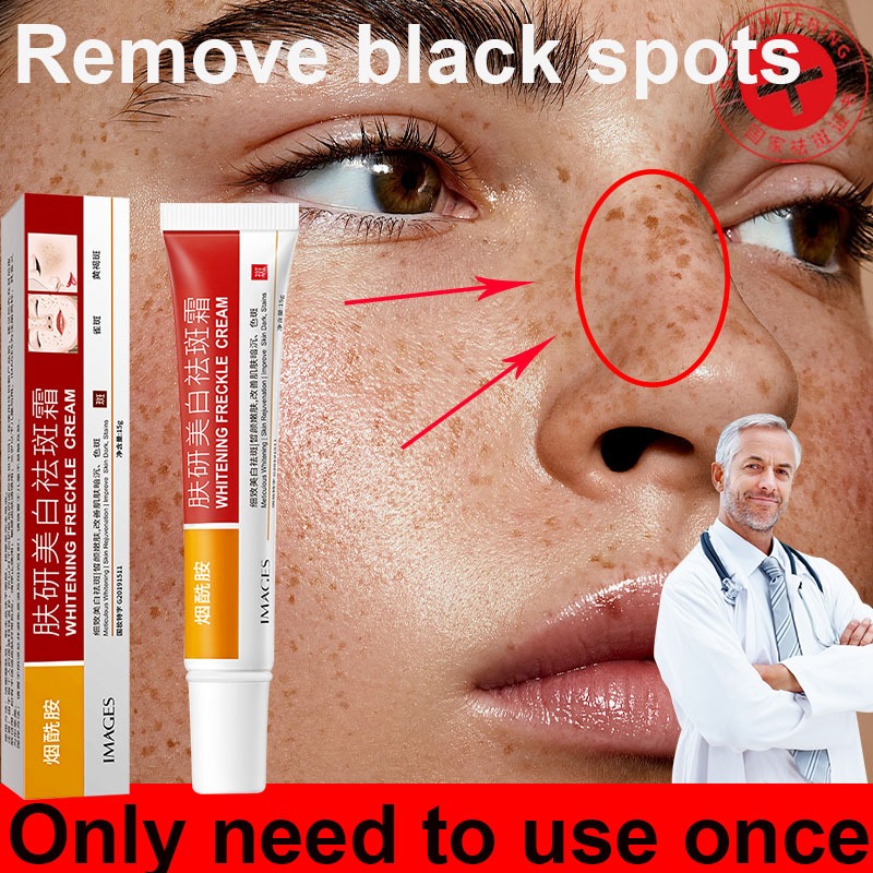 Niacinamide freckle removing cream whitening and removing melasma age ...