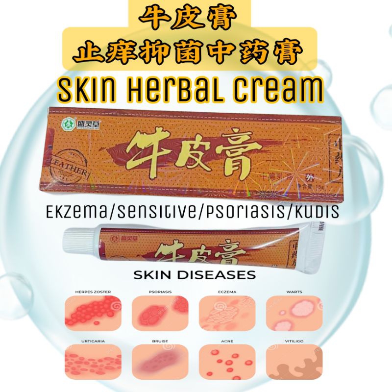 🔥牛皮膏 止痒抑菌中药乳膏 Ubat Cream Ekzema/Panau/Psoriasis Krim Cina Herba💯 ...