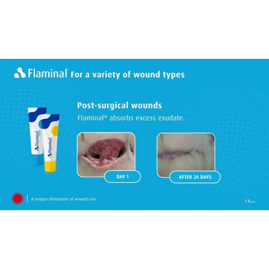 Flen Health Flaminal Forte / Hydro 50g For Wound, Pressure / Diabetic ...