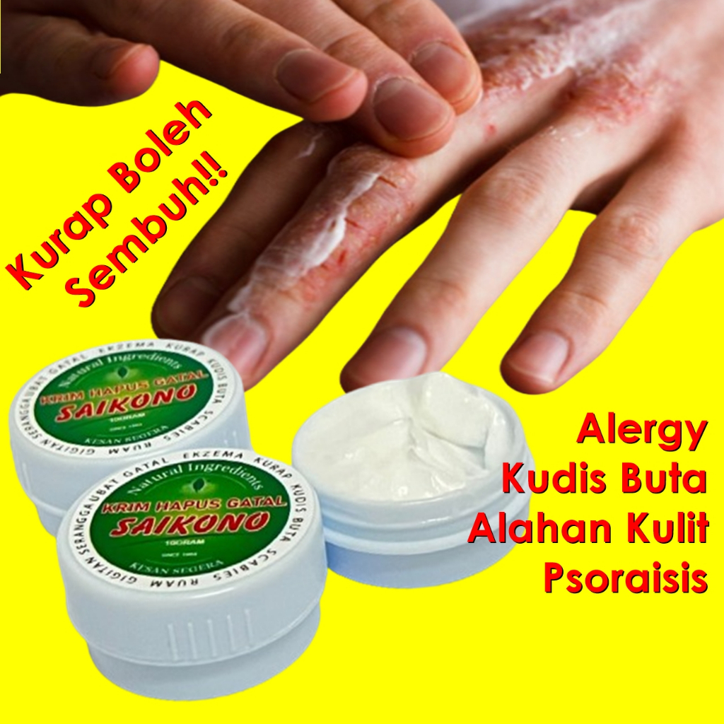 Cream Saikono Untuk Kulit Gatal Kurap Kudis Buta 10gram | Shopee Malaysia