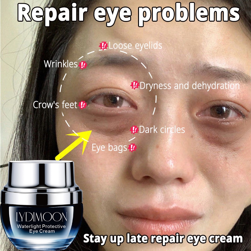 Stay up late repair eye cream to remove fat particles eye wrinkles bags ...