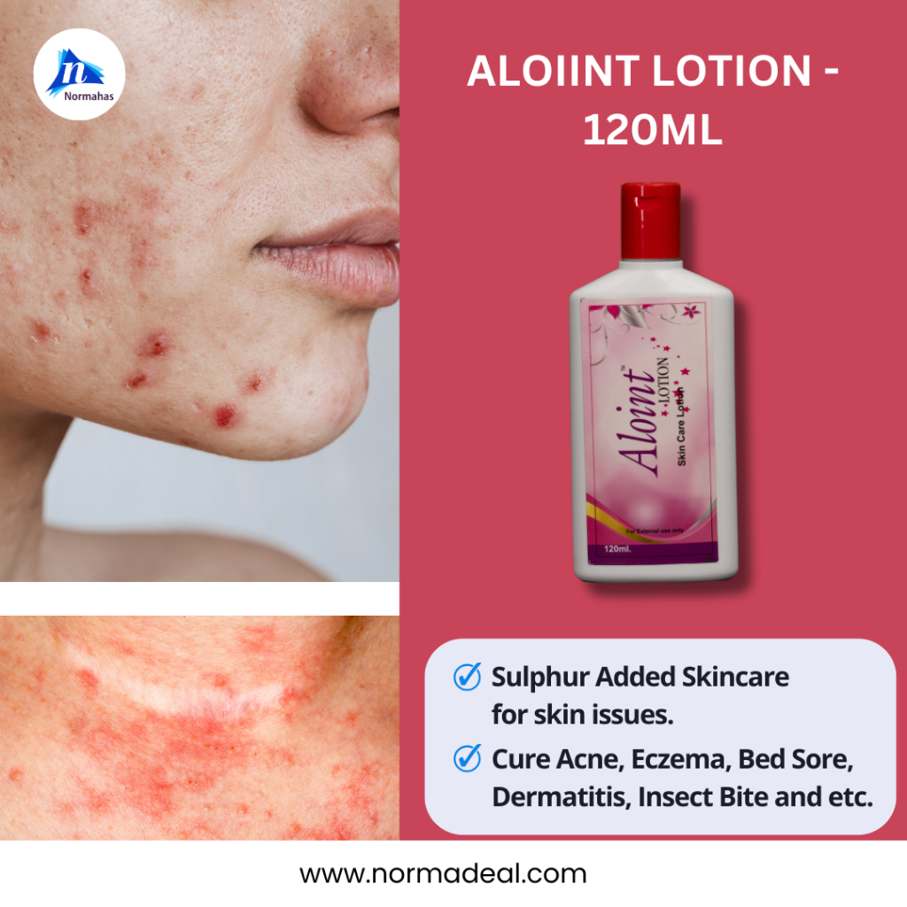 Aloint Lotion,Calamine Lotion 120ml | Shopee Malaysia