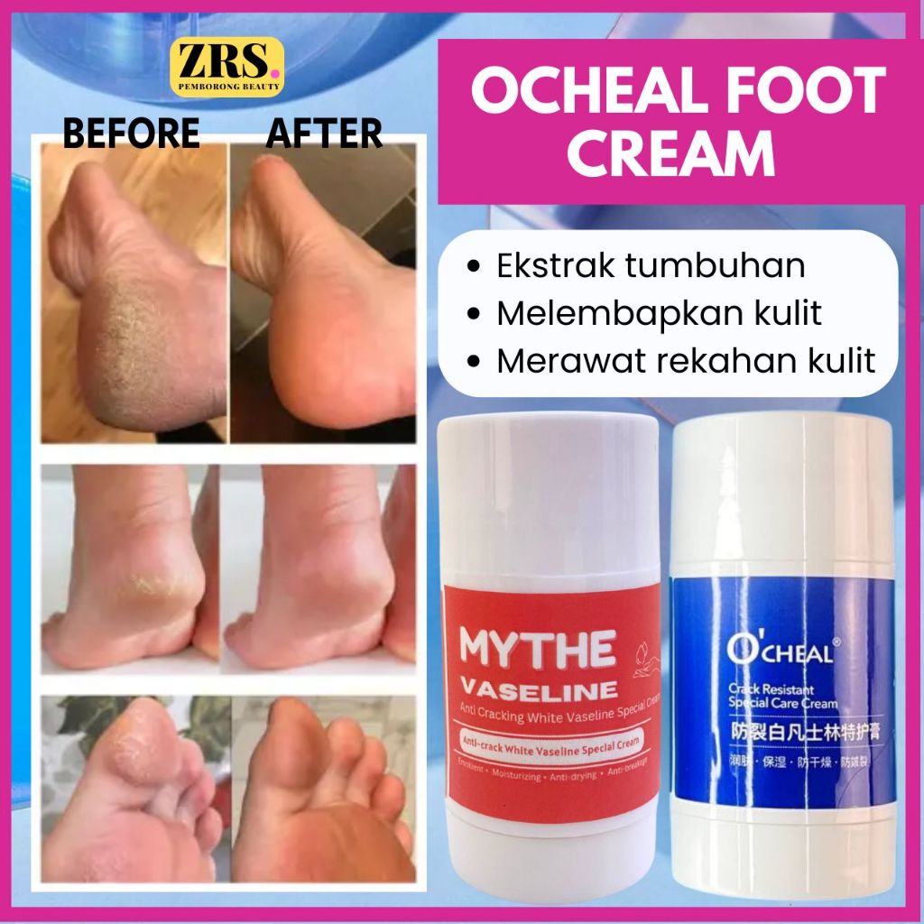 Ocheal Anti-pengeringan retak kaki krim tangan retak pembaikan ...