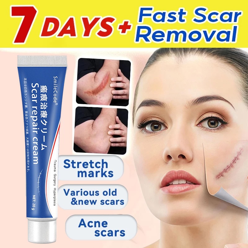 Japanese ubat parut Scar Removal Gel Keloid Scar Remover Stretch Marks Hyperplasia Cesarean Acne ...
