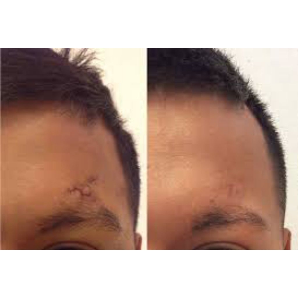[PARUT HILANG] Krim Parut Thailand by klinik | Shopee Malaysia