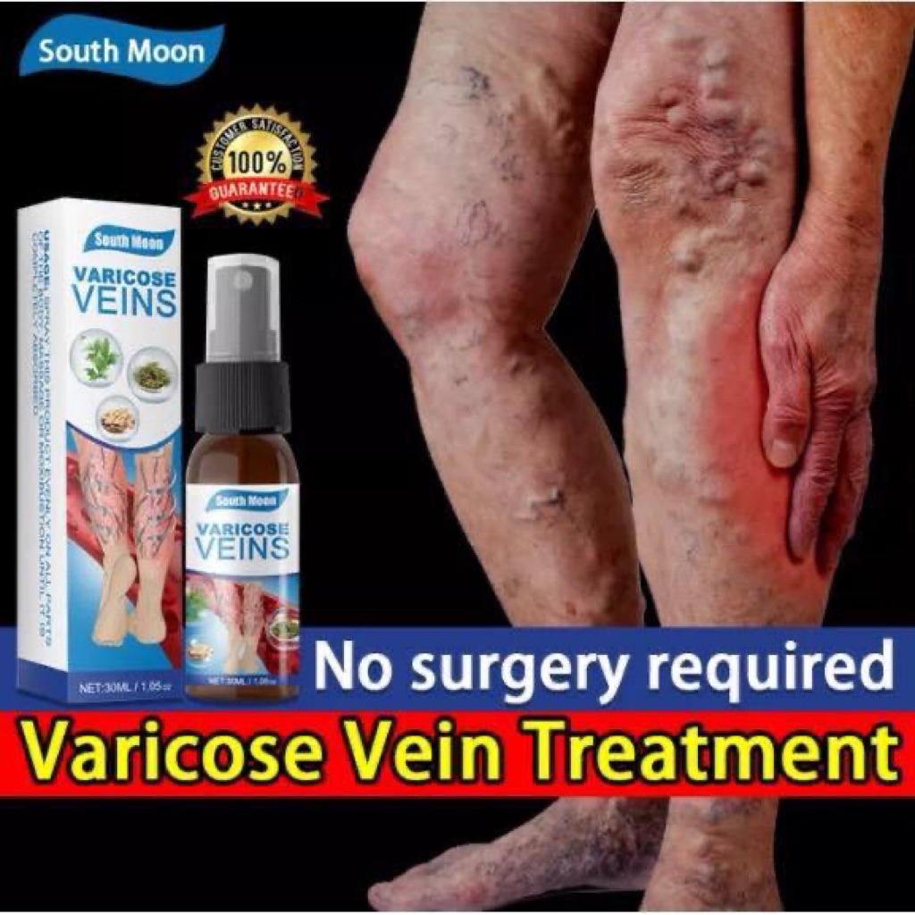 SPRAY VARICOSE VEINS Spray Rawat urat bengkak hijau labah penghilang ...