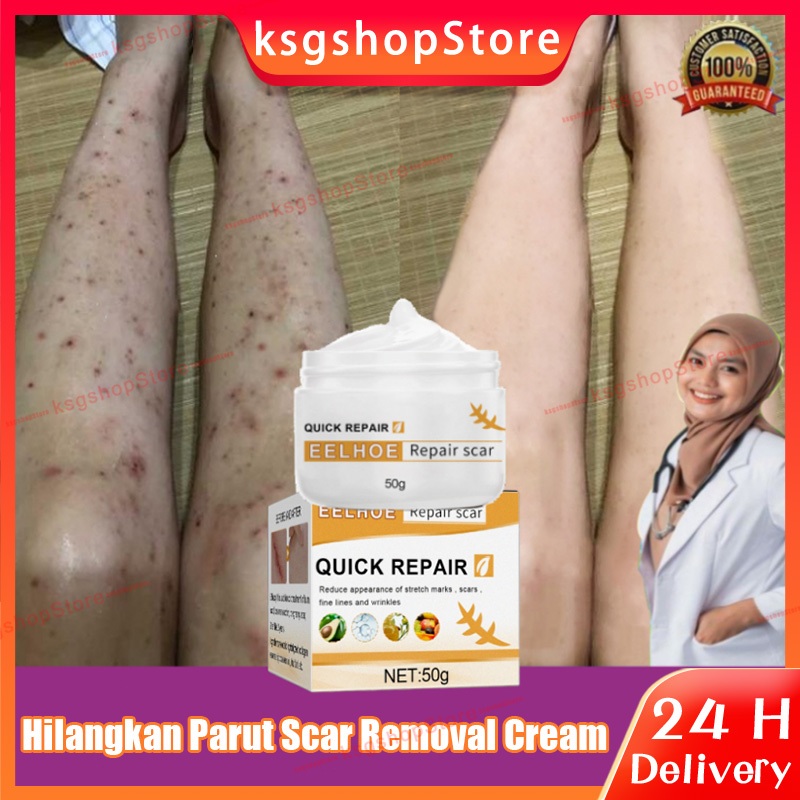 Krim Hilangkan Parut Hitam Scar Removal Cream Hilangkan Parut Kaki ...