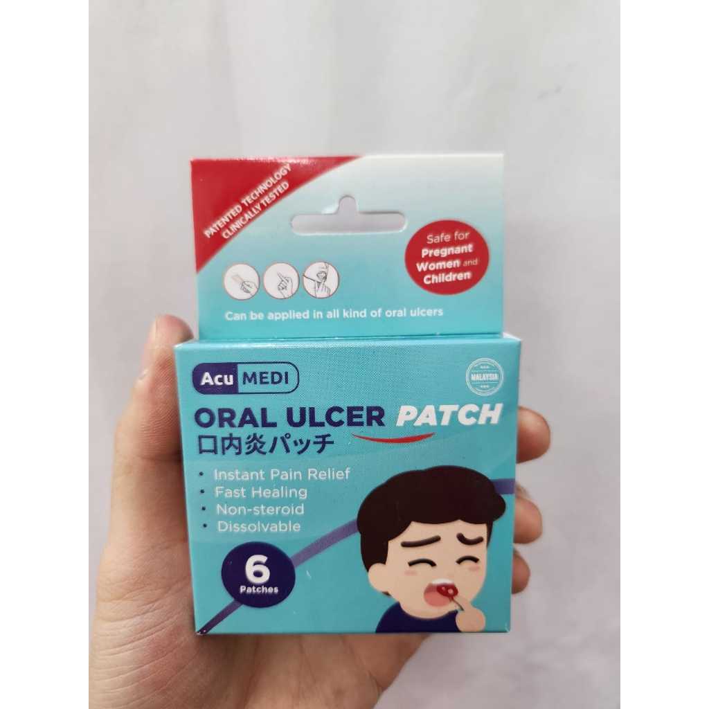 ACUMEDI ORAL ULCER PATCH PATCHES 6S | Shopee Malaysia