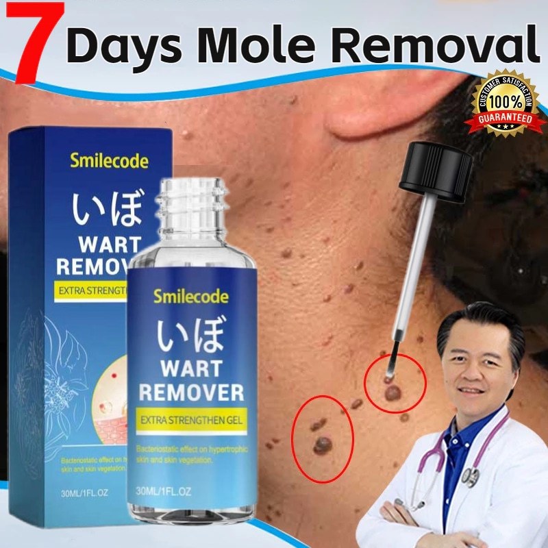 Ubat buang tahi lalat hidup skin tag remover wart mole lighten melanin ...