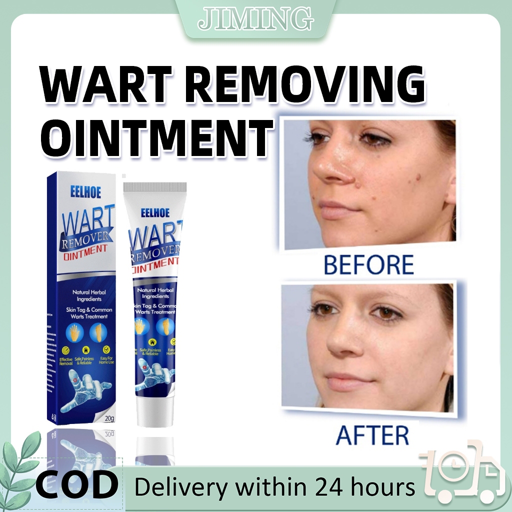EELHOE Wart Removal Cream Effective Corns Filiform Warts Skin Blemishes ...