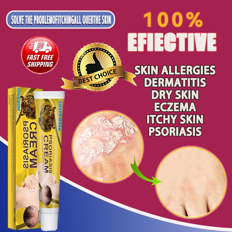 COD External use on the skin Anti-itch ointment Psoriasis eczema cream ...