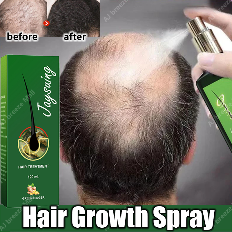 Hair Tonic Growth Fast Hair Growth Spray Ubat Rambut Botak Serum Rambut ...