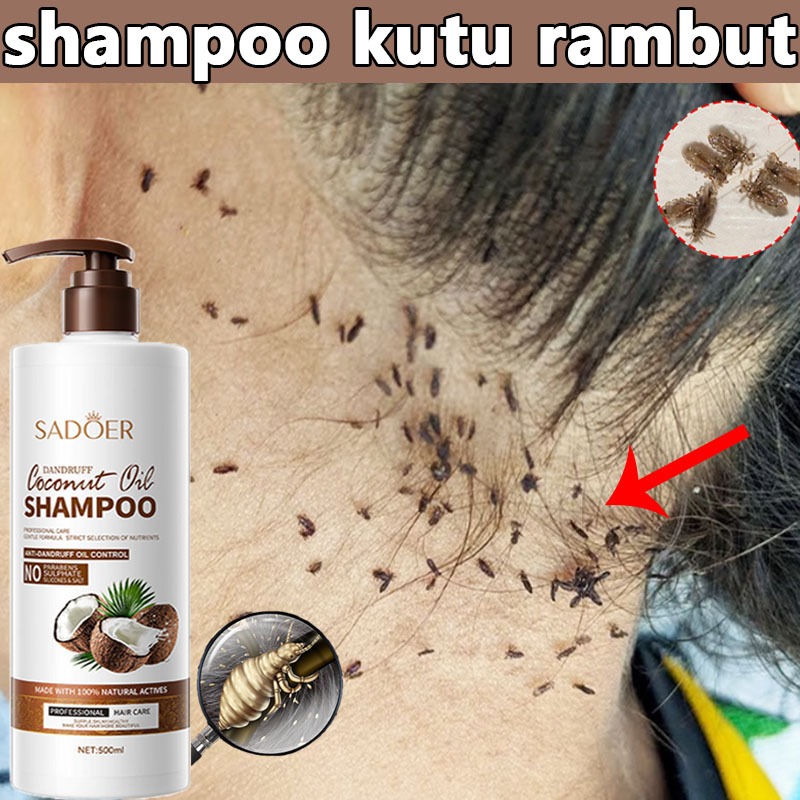shampoo kutu rambut ubat kutu rambut syampu kutu kanak and dewasa anti ...
