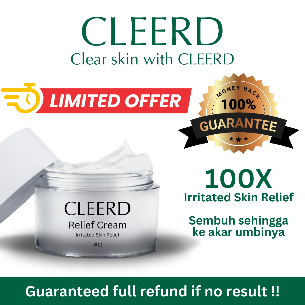 CLEERD Relief Cream Ekzema Ubat Gatal Kulit Panau Kurap Gatal Krim ...