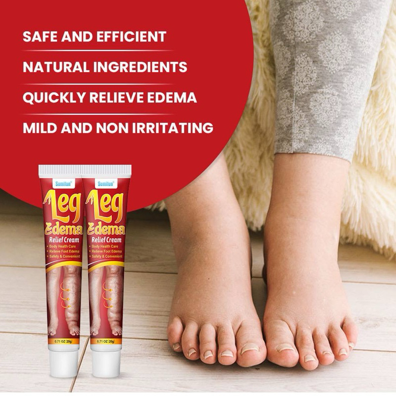 LEG EDEMA CREAM Krim urutan edema anti bengkak penghilang bengkak edema ...