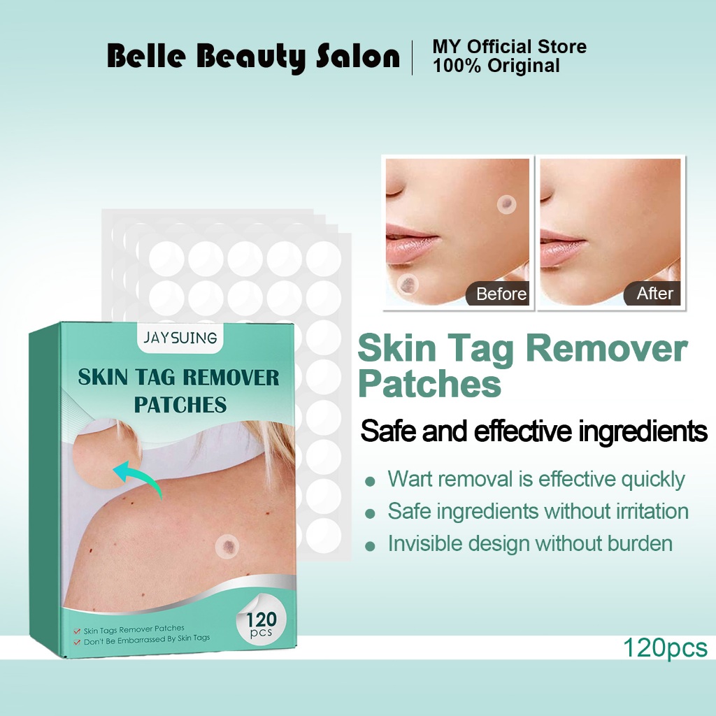 Warts Remover Patch 120pcs Skin tags remover treatment patch Safe ...