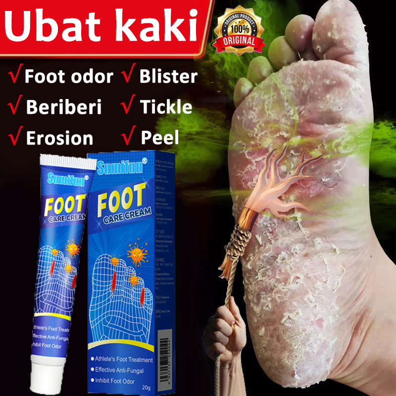 ubat kulat kaki ubat kaki berbau Kulat air Kaki gatal berbau Foot ...