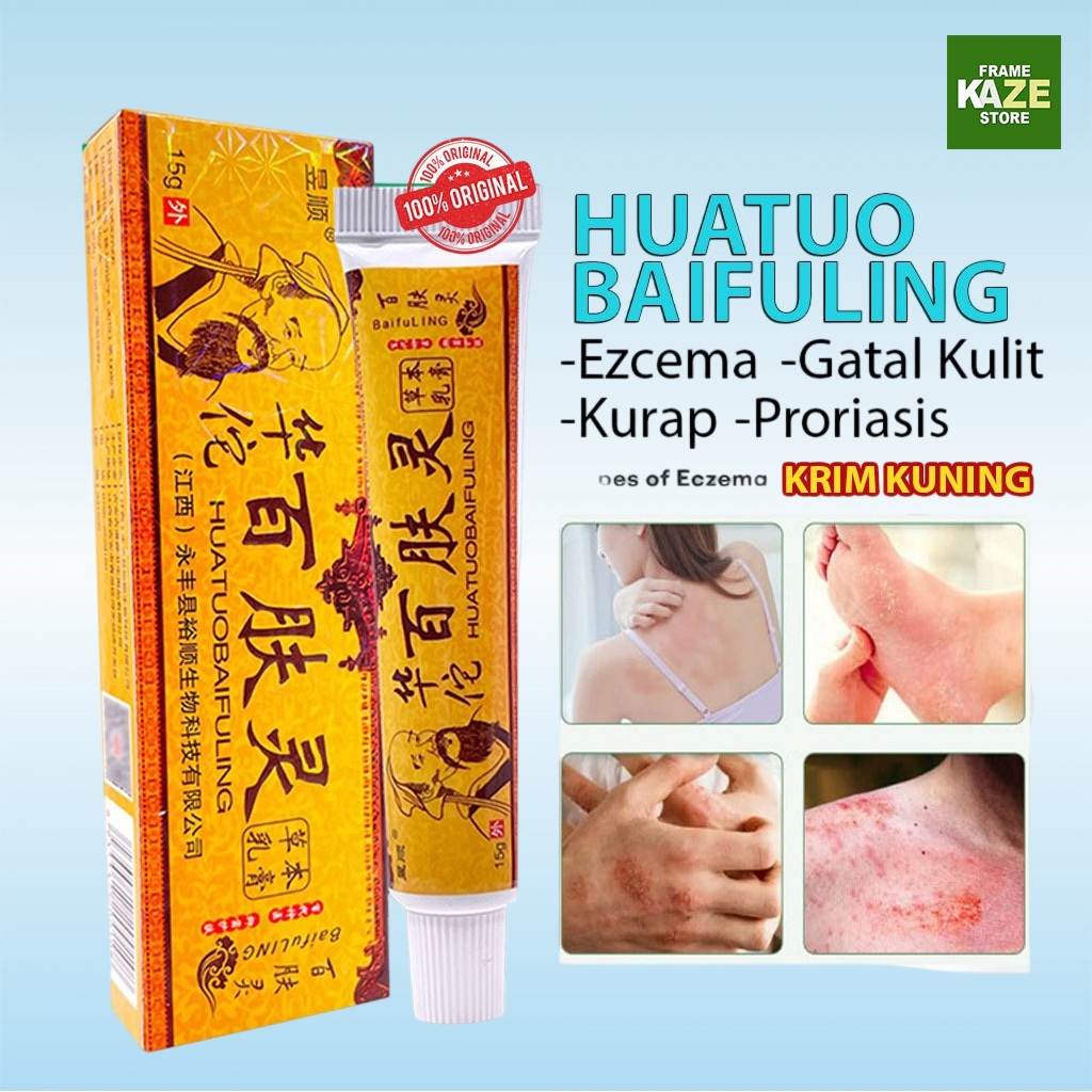 Ekzema Psoriasis Kurap Gatal Kulit Ubat Krim Herba Cina 15g / Eczema ...
