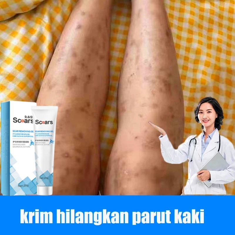 Scar Removal Cream stretch mark cream Skin Care ubat hilangkan parut ...