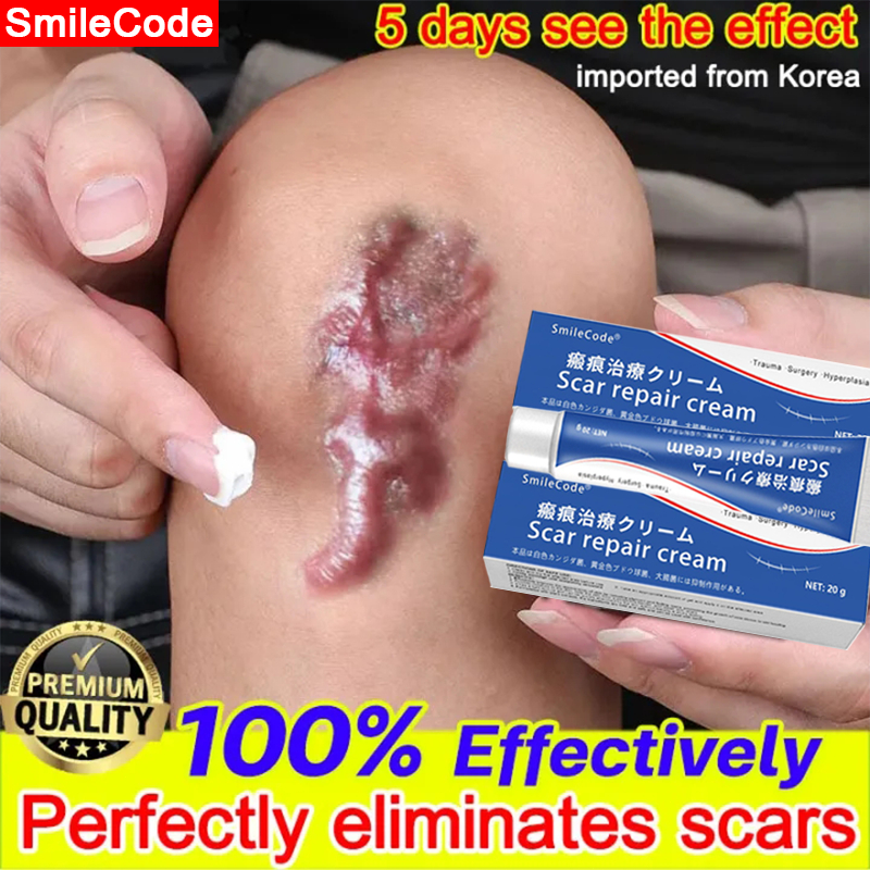 Scar Remover Cream scar treatment scar gel Remove Stretch Marks Scald ...
