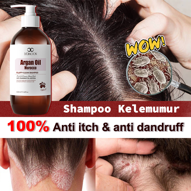 Shampoo kelemumur Shampoo kutu rambut Psoriasis shampoo Anti dandruff ...