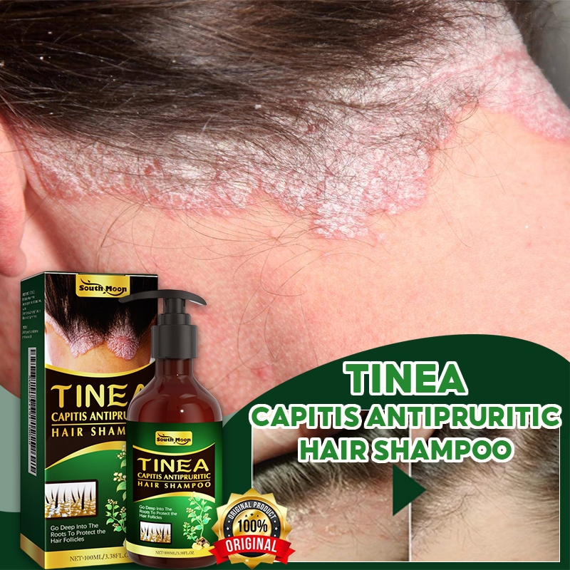 tinea capitis antipruritic hair shampoo psoriasis shampoo anti dandruff ...