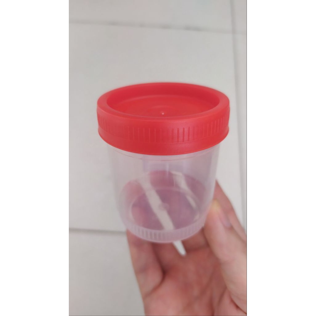 Urine container specimen collection bottle 90ml sterile | Shopee Malaysia