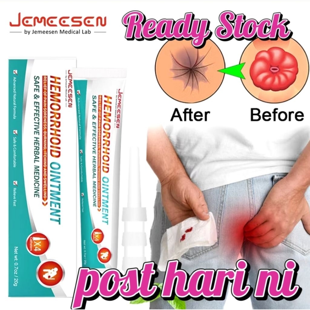 Jemeesen Hemorrhoid Cream Ubat Buasir 100% Berkesan Herba Cina Krim Buasir Relieve Pain, Itching ...