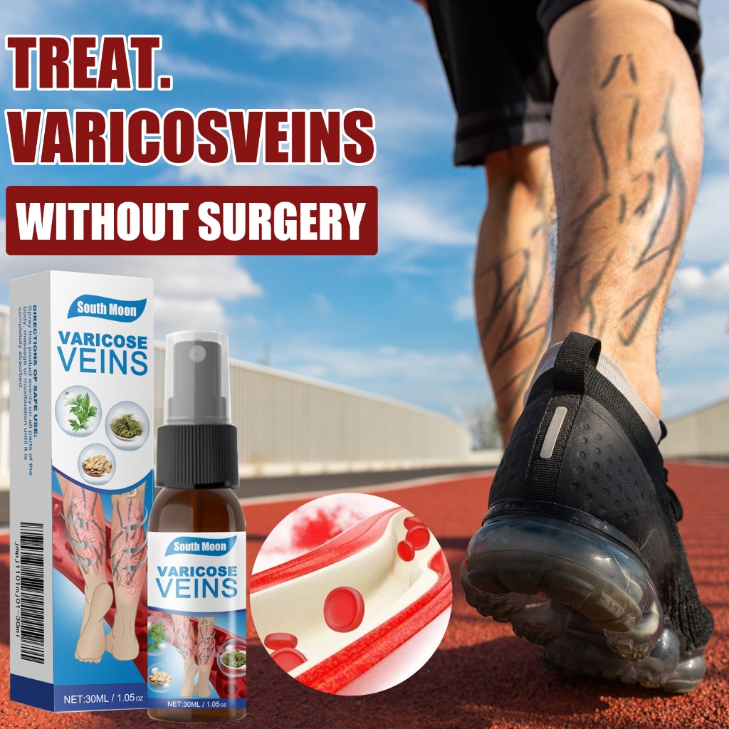 South Moon Varicose Veins Spray 30ml Relieve Leg Pain Swelling Promote ...