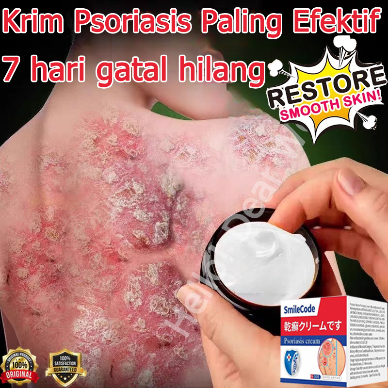 [Painless shedding]krim gatal kulit eczema psoriasis cream Herbal antibacterial Anti itch Relief ...