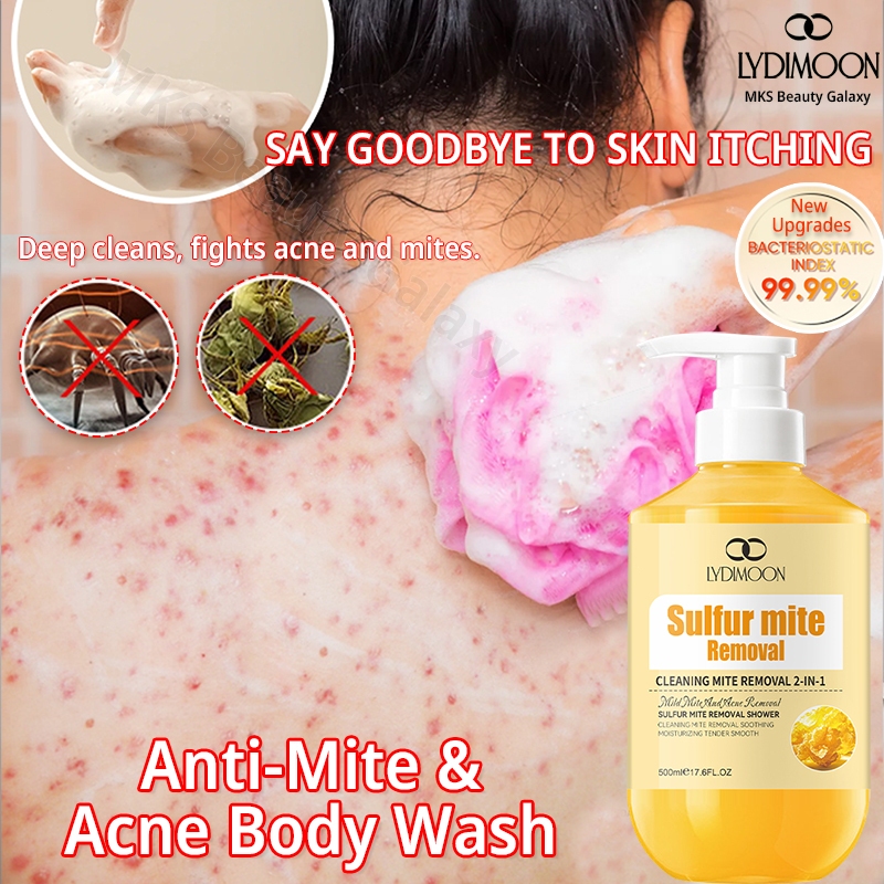 Acne Body Wash Antibacterial Shower Gel Mite Body Wash 500ml sulfur Antibacterial&Cleansing Mite ...