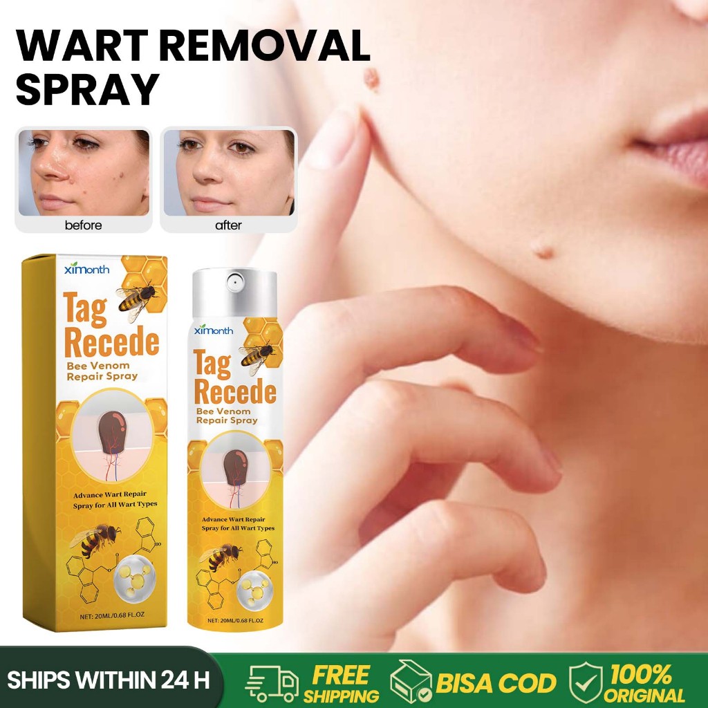 Bee Venom Wart Removal Spray 20ml Tag Recede Bee Venom Spary Skin tag ...