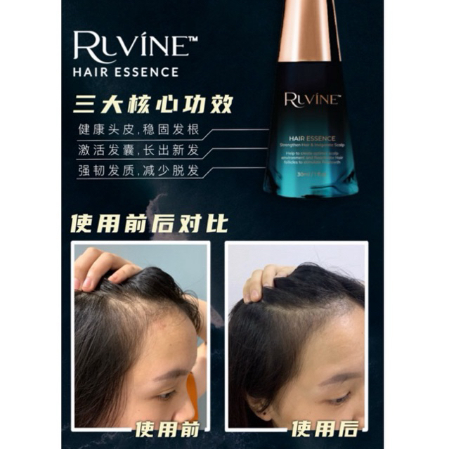 (Ready Stock) Ruvine Hair Tonic Hair essence 生发液 ｜ 护法｜秃头｜脱发｜生发 100% ...