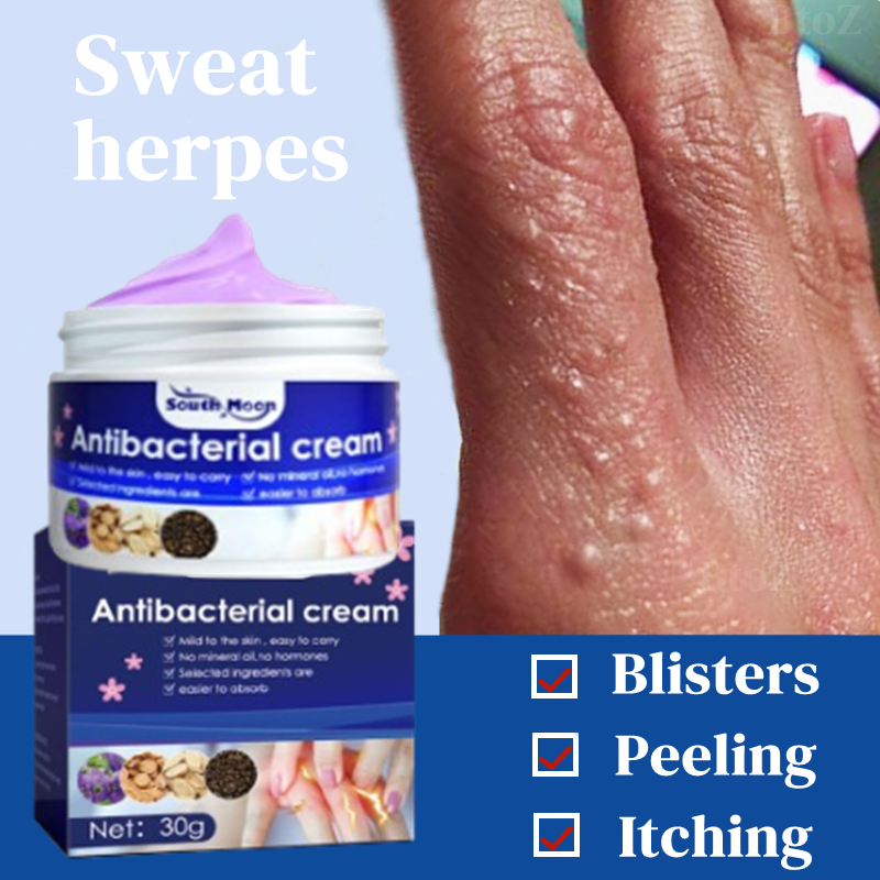 krim gatal kulit eczema cream Psoriasis Cream Effective Itching Sweat ...