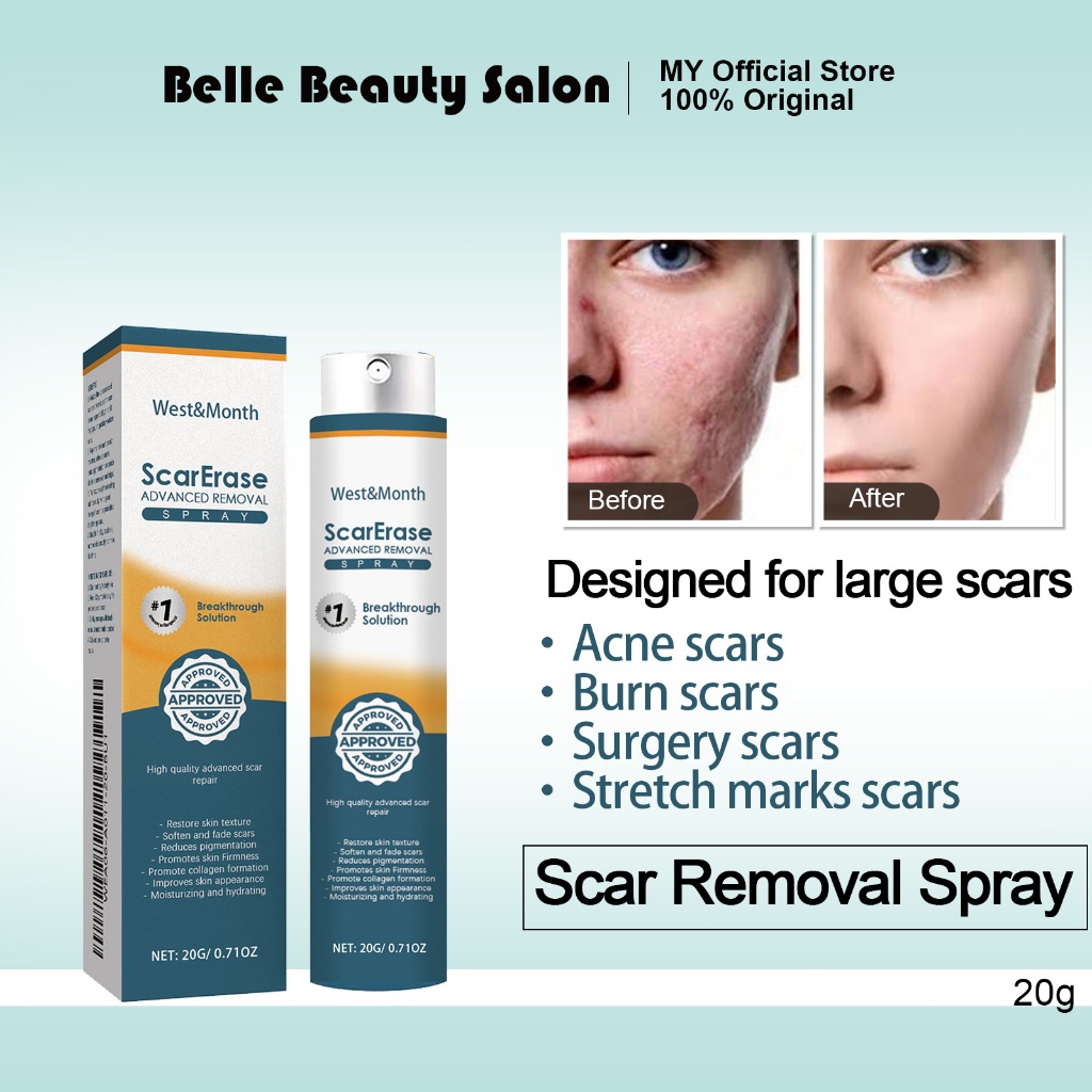 Scar Removal Spray20g Silicone Scar Gel Spray for Large Scars Stretch ...