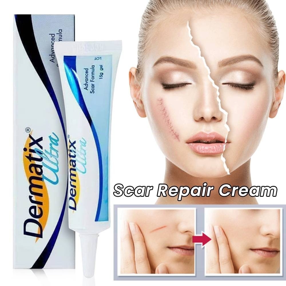 DERMATIX ULTRA ADVANCED SCAR 15G | Shopee Malaysia