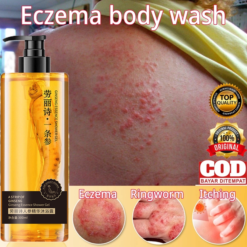 acne body wash sabun gatal kulit 300ml psoriasis body wash jerawat badan gatal kulit badan anti ...