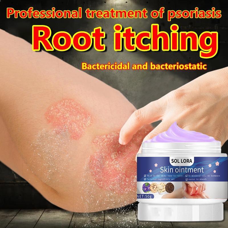 Antibacterial Psoriasis Cream Nourishing Dermatitis Eczema Ointment ...