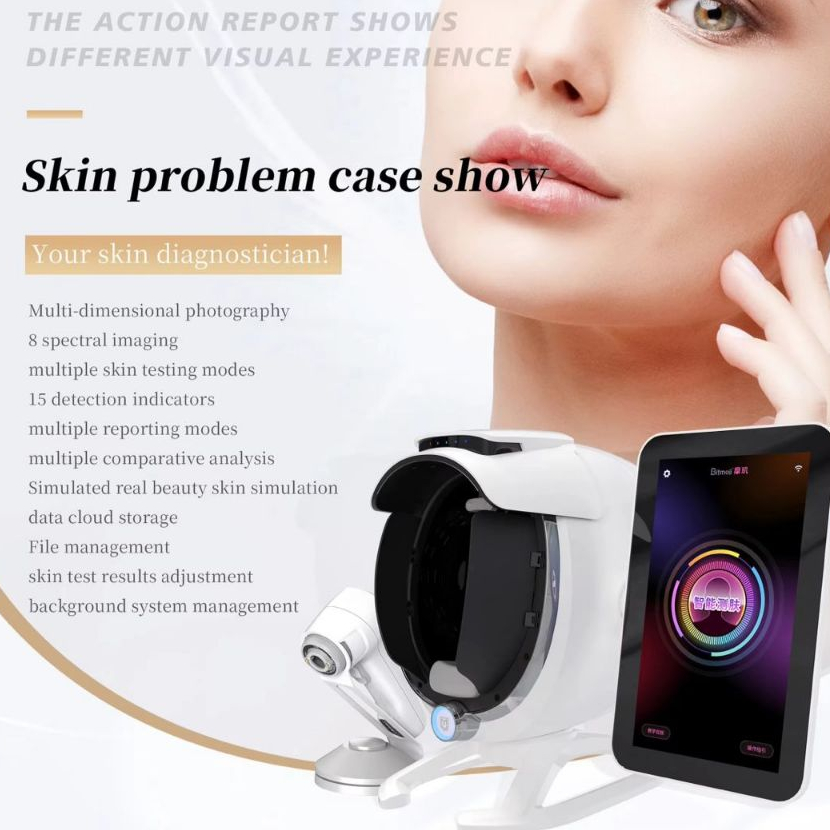 Intelligence 3D AI face skin analyzer scan analysis scanner skin ...