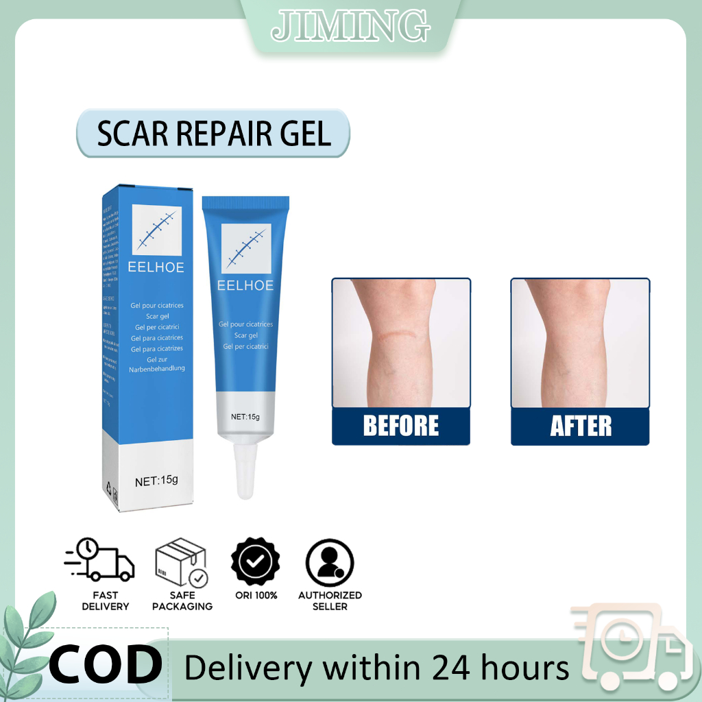 Scar Removal Cream 15g Quickly Remove The Wound Repair Old Scars Krim ...