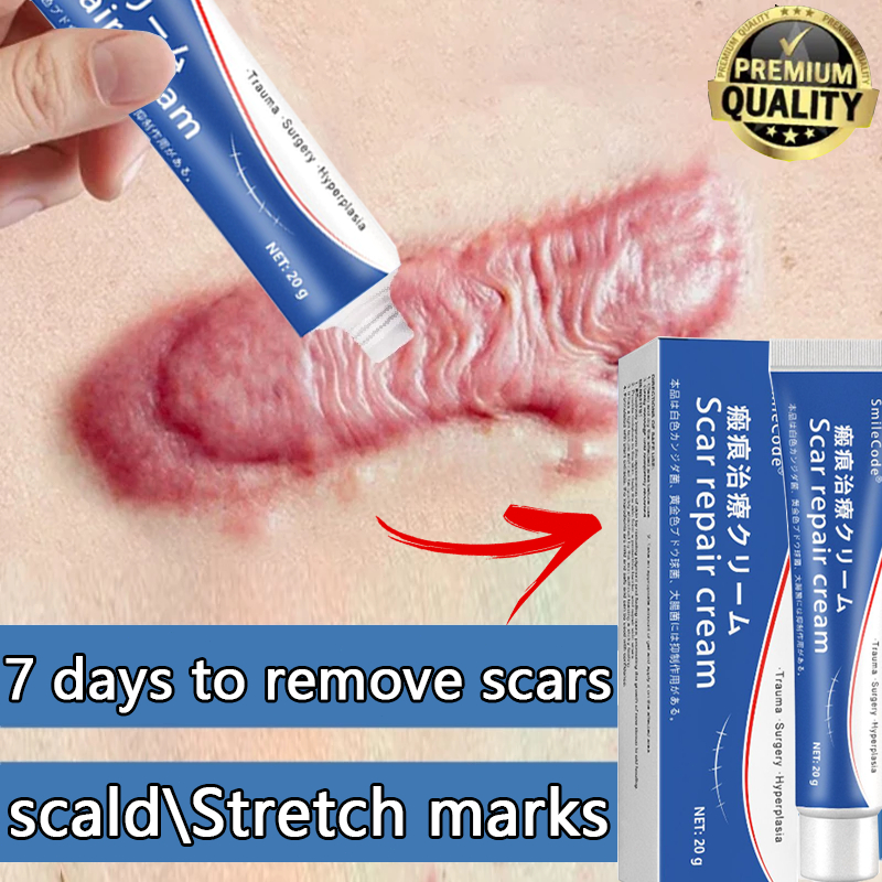 Scar removal cream Remove Stretch Marks Scald Burns Bite Scar Ubat Krim ...