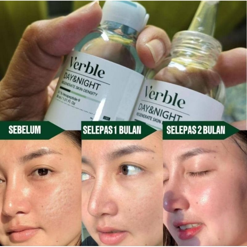 SERUM VERBLE DAY N NIGHT 🔥Serum Whitening / Pitted Scar Reduce Dark ...