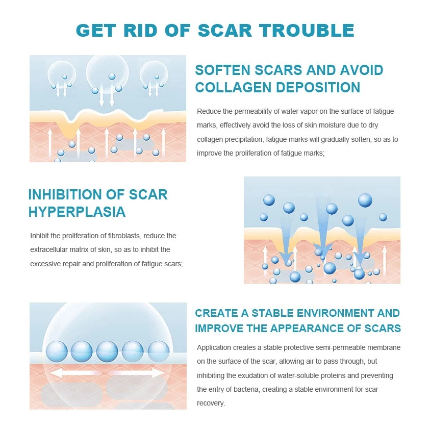 Scar removal cream Krim hilangkan parut hitam Hilangkan parut kudis ...