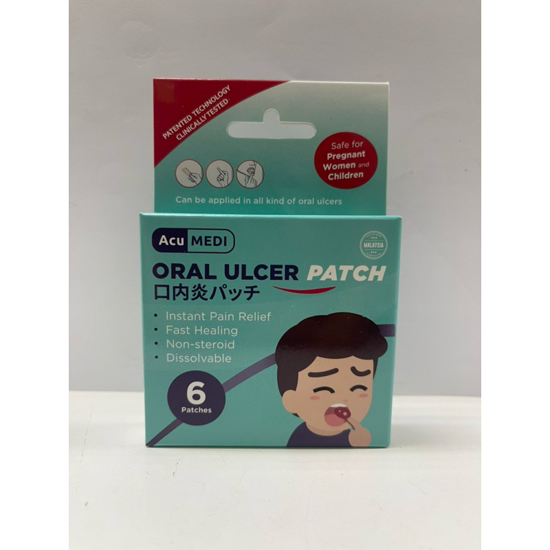 Oral Ulcer Patch (6 patches) | Shopee Malaysia